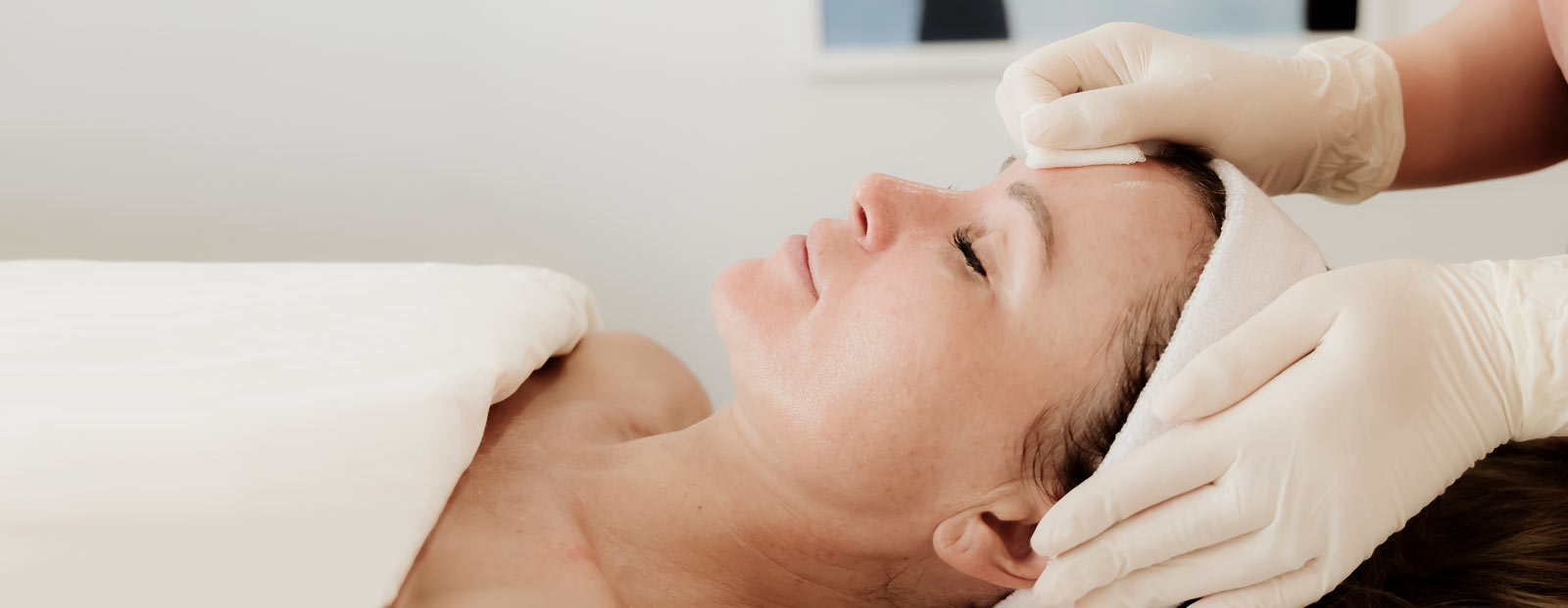 Skin Peels | About Face Medical Aesthetics